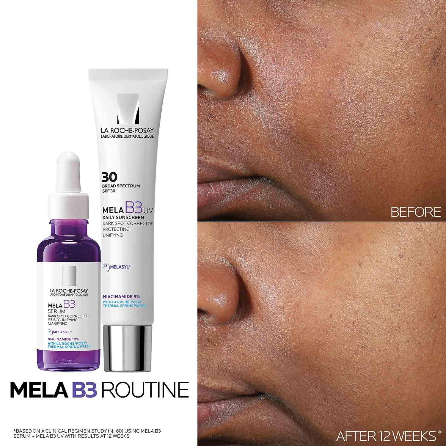 Mela B3 Dark Spot Serum With Melasyl™ + Niacinamide | La Roche-Posay