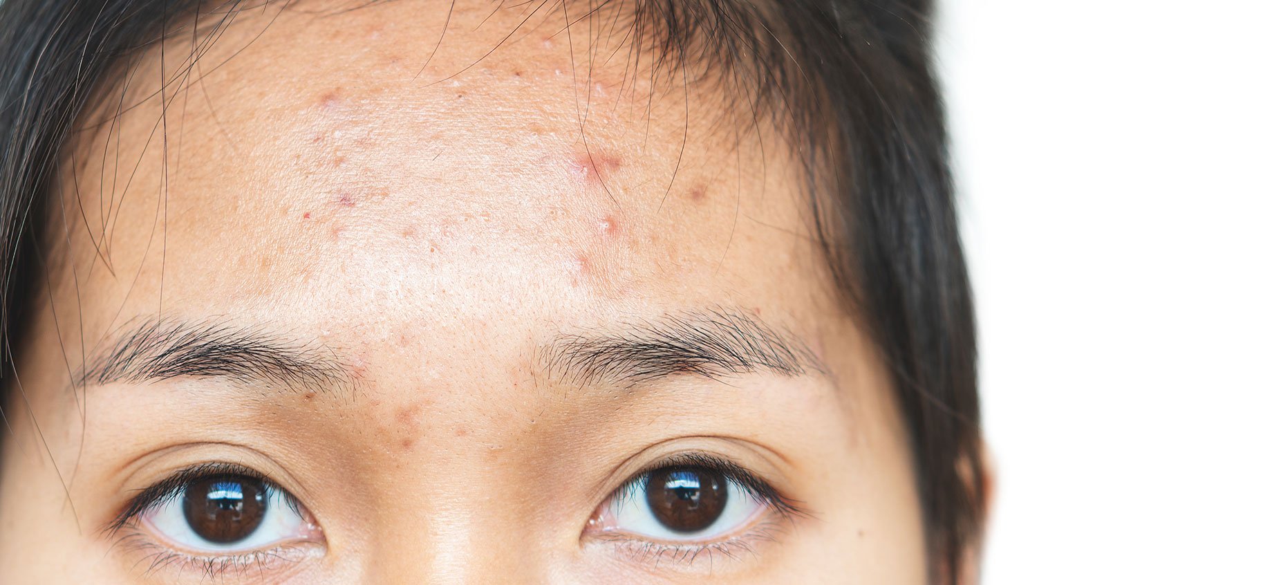 Puberty Done Right Potato